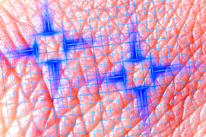 Computer model reveals the secrets of skin ageing and how to combat it ...