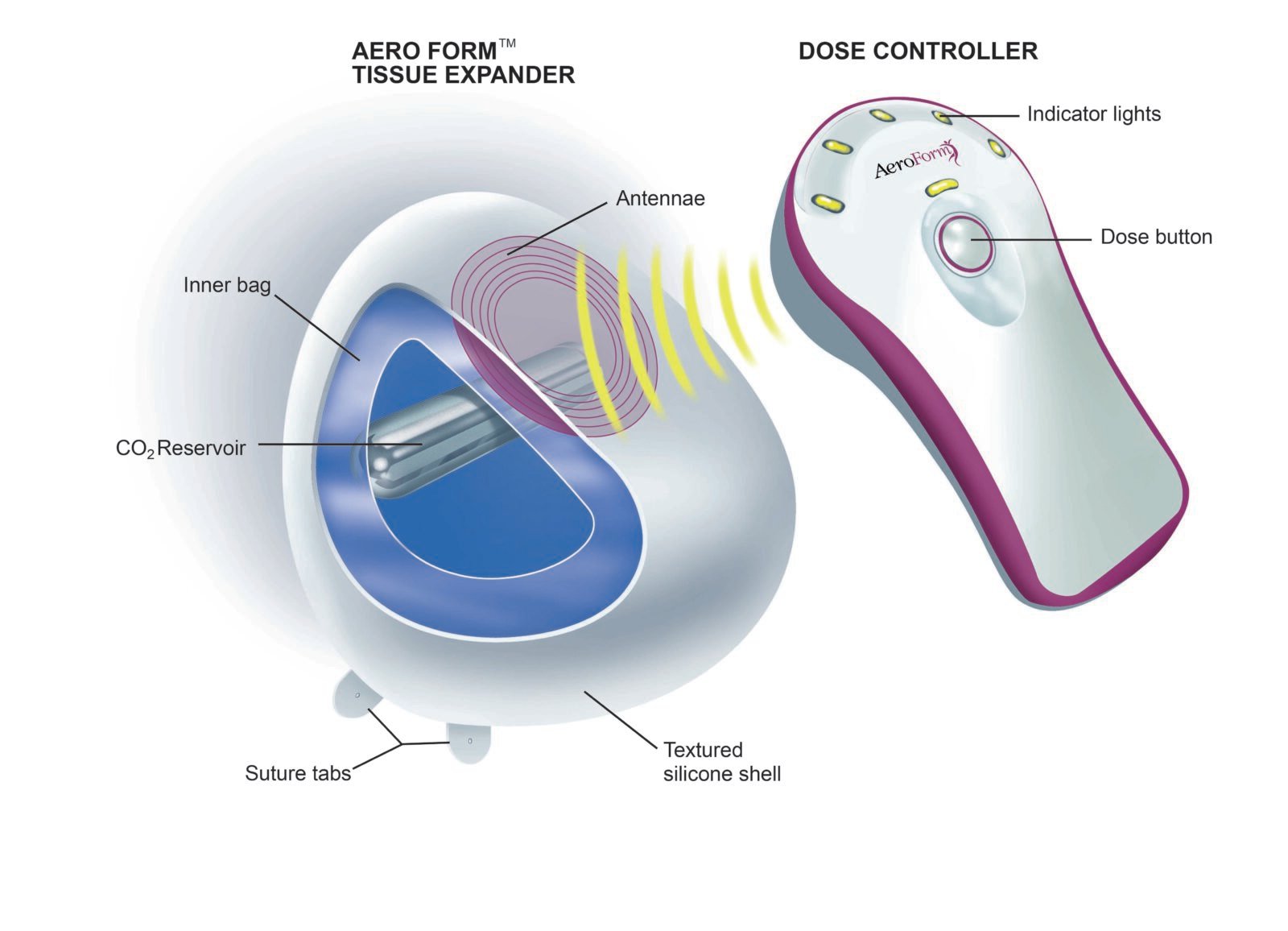 Advancements in breast reconstruction | PRIME Journal