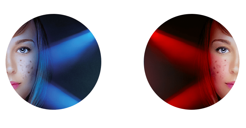 Photodynamic Therapy for Acne Management | PRIME Journal