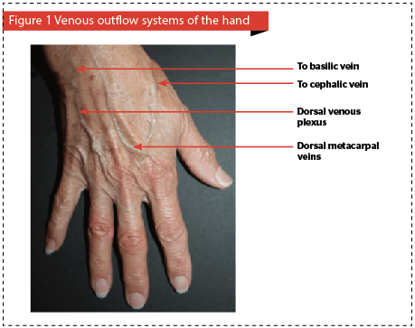 Hand Rejuvenation: Three-Step Combination Therapy | PRIME Journal
