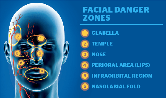 Filler Danger Zones : The Most High-Risk Injection Zones for Filler ...